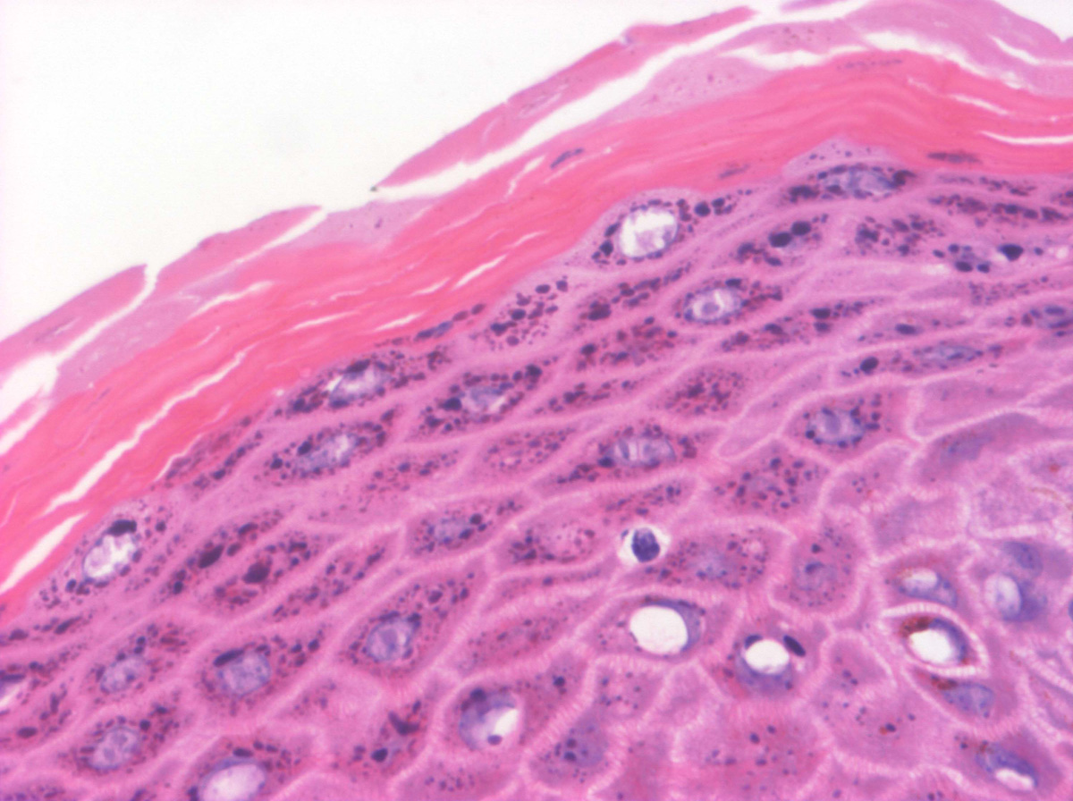 LA EPIDERMIS | Grado en Veterinaria