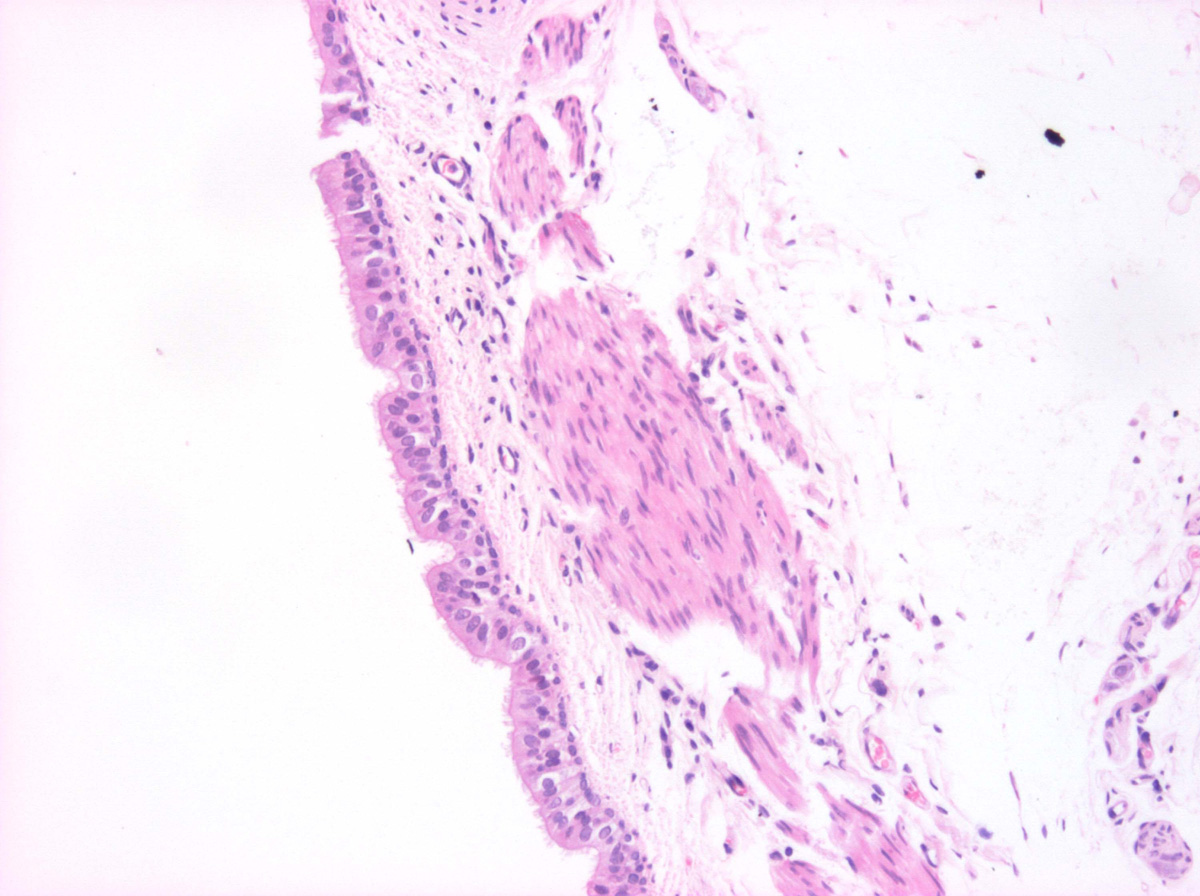 LA TRÁQUEA | Grado en Veterinaria